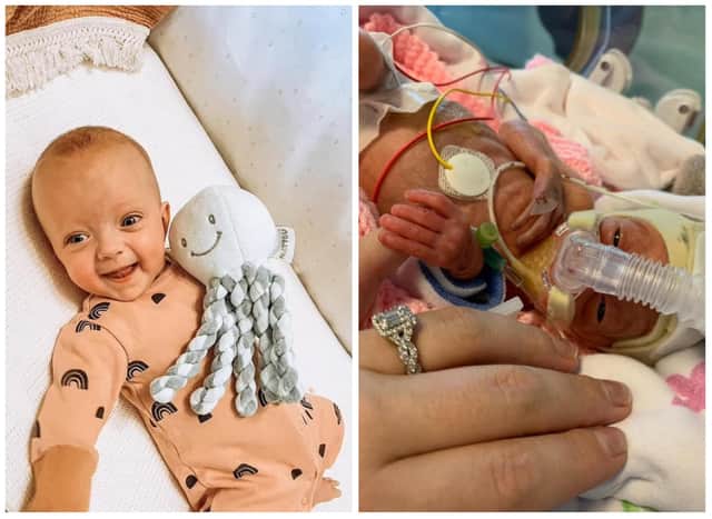 Premature Baby Born at 25 Weeks Heads Home for Christmas After Miracle ... Premature Baby Born at 25 Weeks Heads Home for Christmas After Miracle ...